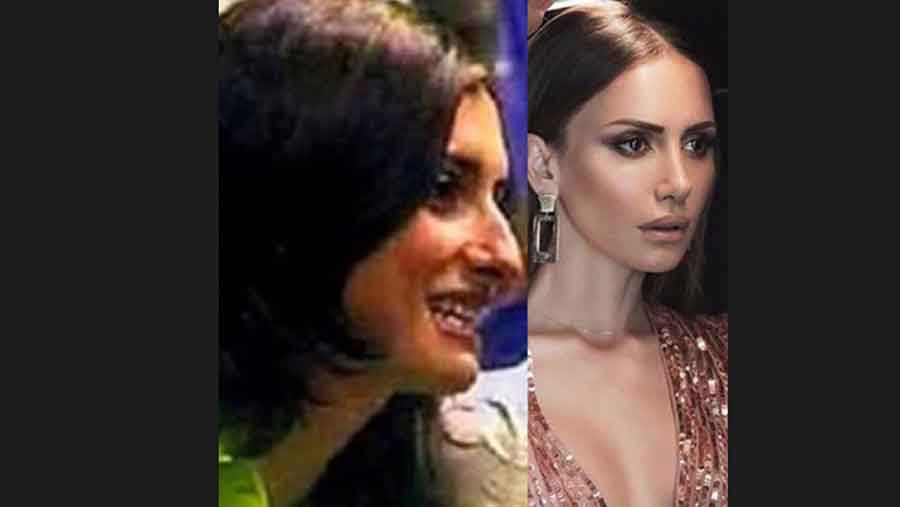 PRIJE I POSLIJE Popularna Emina Jahović NA METI KRITIKA zbog plastičnih operacija (FOTO ...