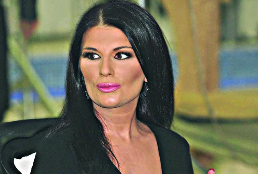 Sanja je opasan virus dobila sa 29 godina: Zbog zdravlja pjevačica ...