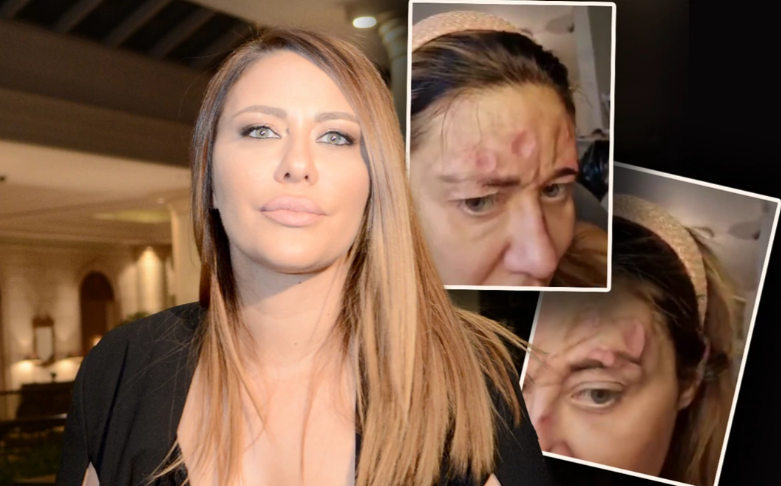 Isplivao još jedan šok snimak Ane Nikolić