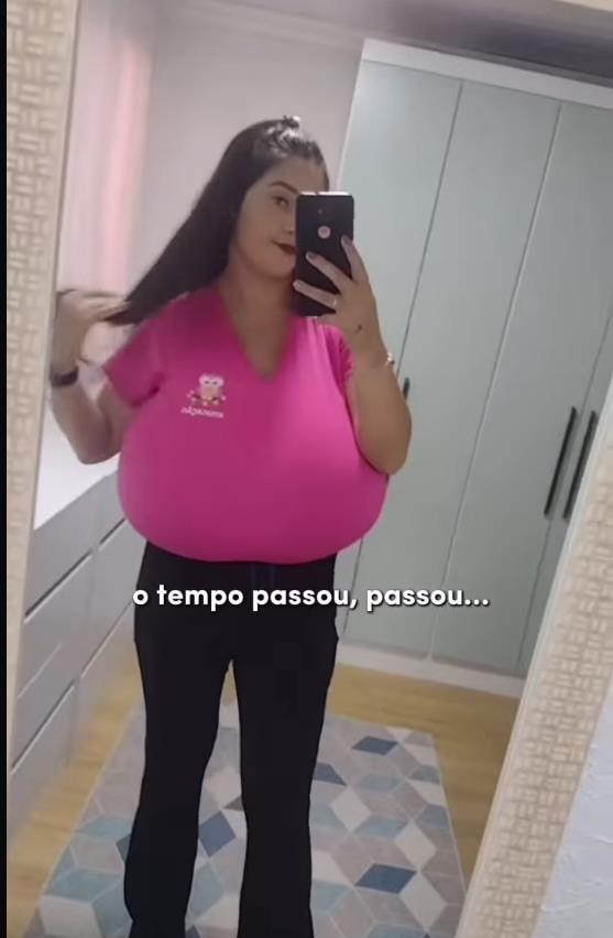 Ubrzani rast grudi, za nekoliko mjeseci su porasle do 12kg, ljekari su ...